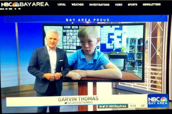 Hand-in-Hand Collaboration to Create Prosthetic Hand for Young ...